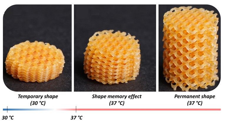 Impression 4D : un avenir prometteur pour la médecine personnalisée ...