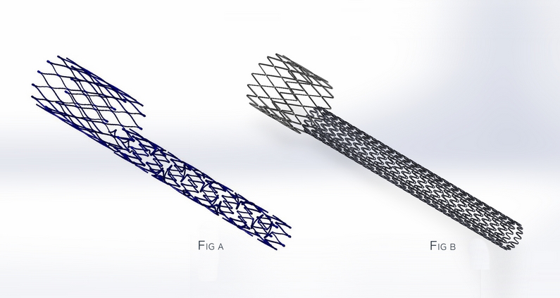 Une avancée récente dans la conception de stents en nitinol – DeviceMed.fr