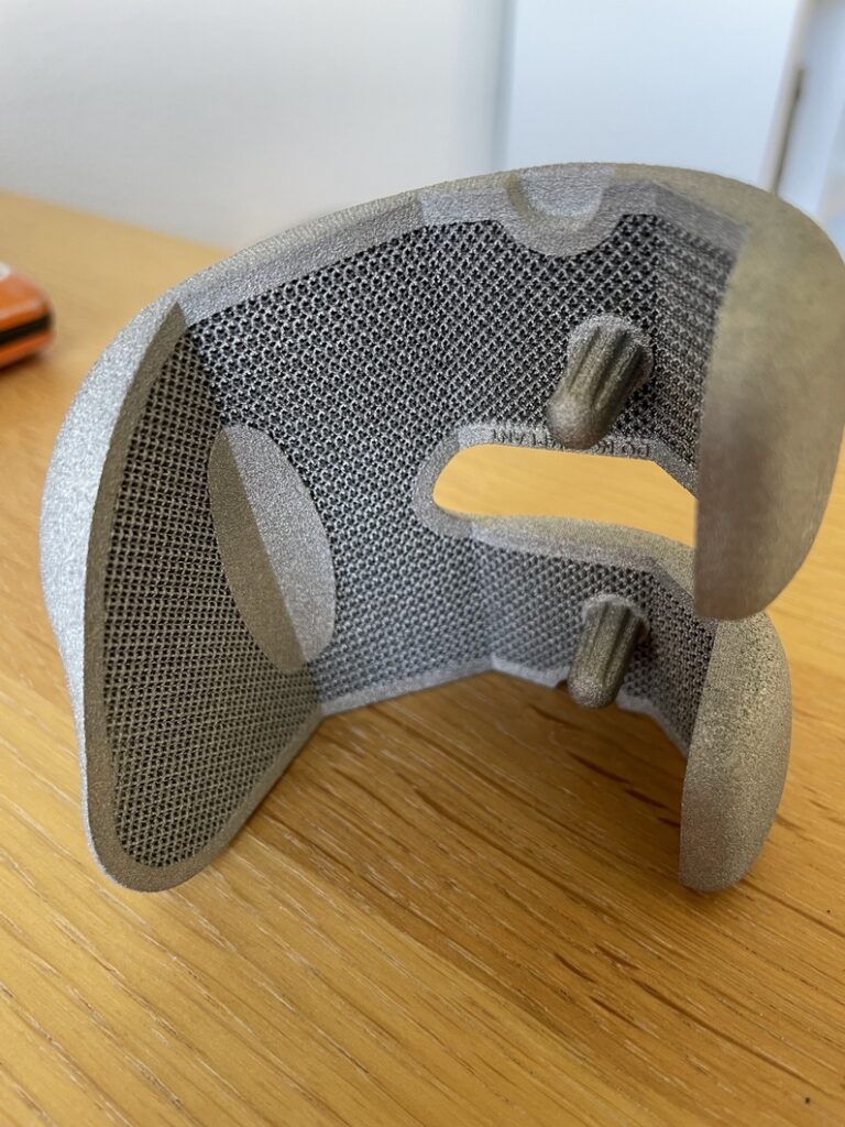 GE Additive innove dans la fabrication d’implants métalliques par EBM ...